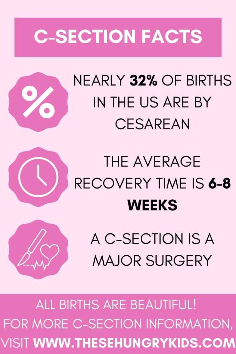Surprising Facts About C-section Births (2021) – These Hungry Kids